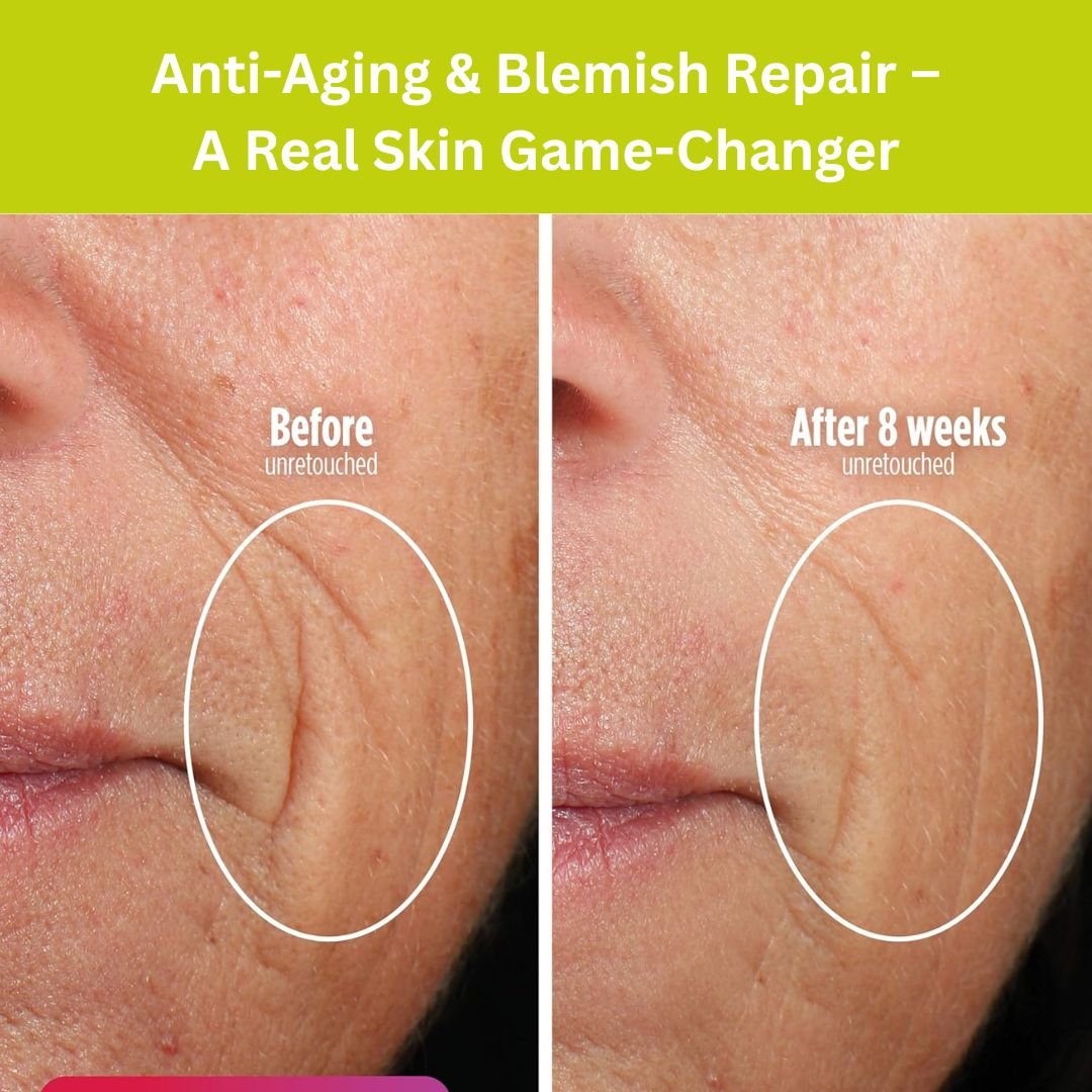 Shark CryoGlow LED Face Mask – Blue Frost | FSA/HSA Eligible | Anti ...